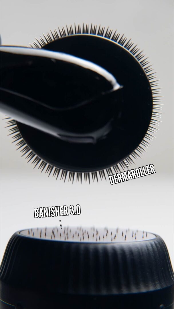Dermaroller vs. Banisher 3.0: Which One Is Best For Your Skin? - The ...